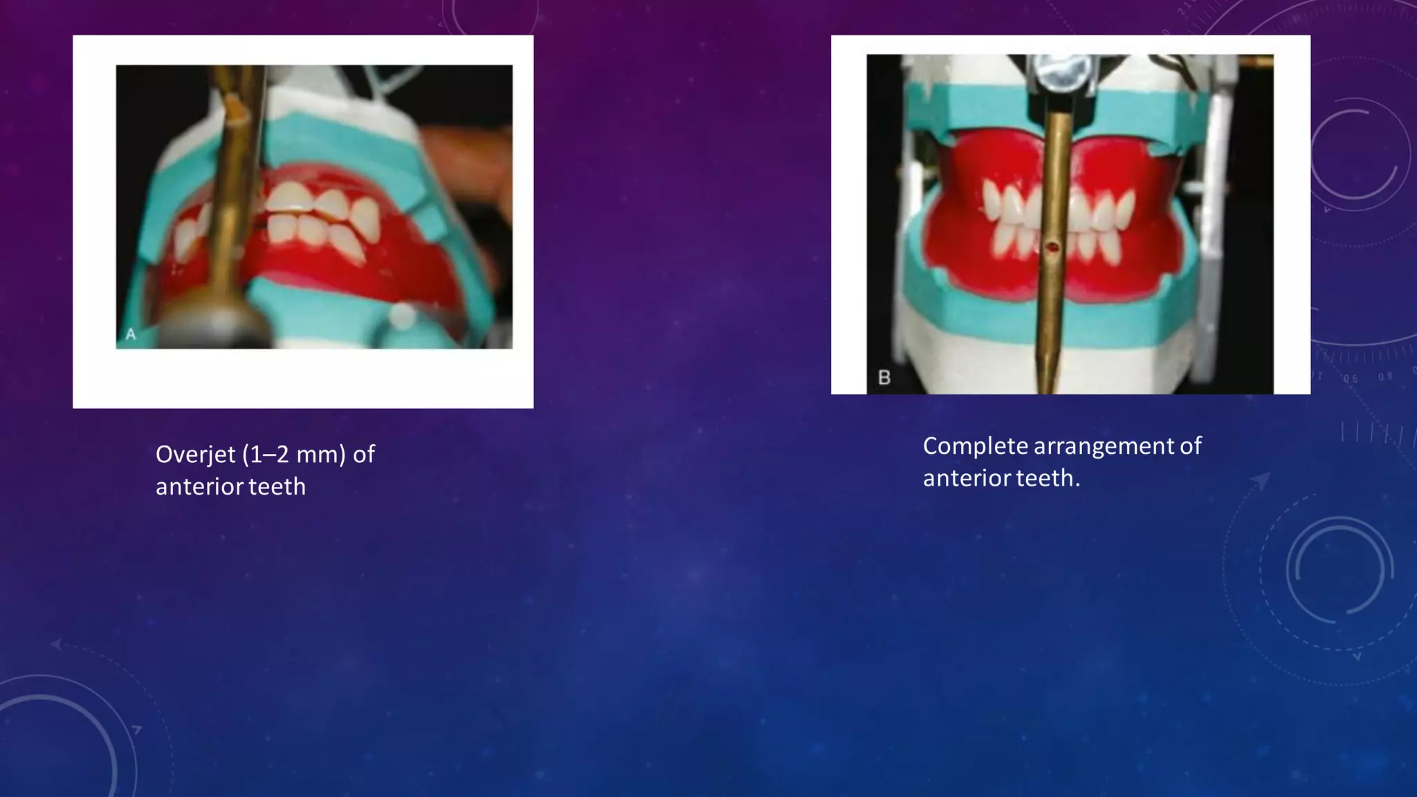 Teeth selection and arrangement | PDF