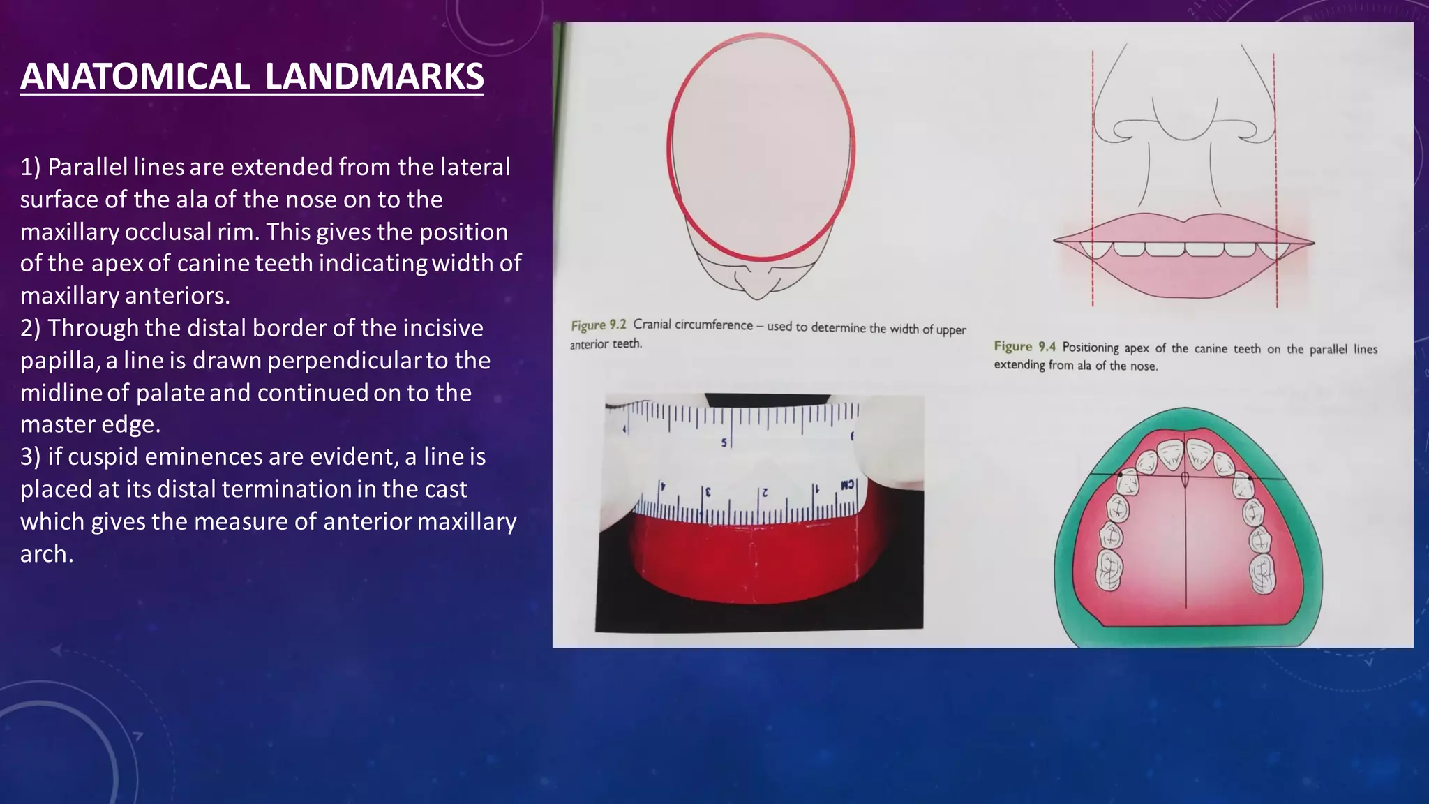 Teeth selection and arrangement | PDF