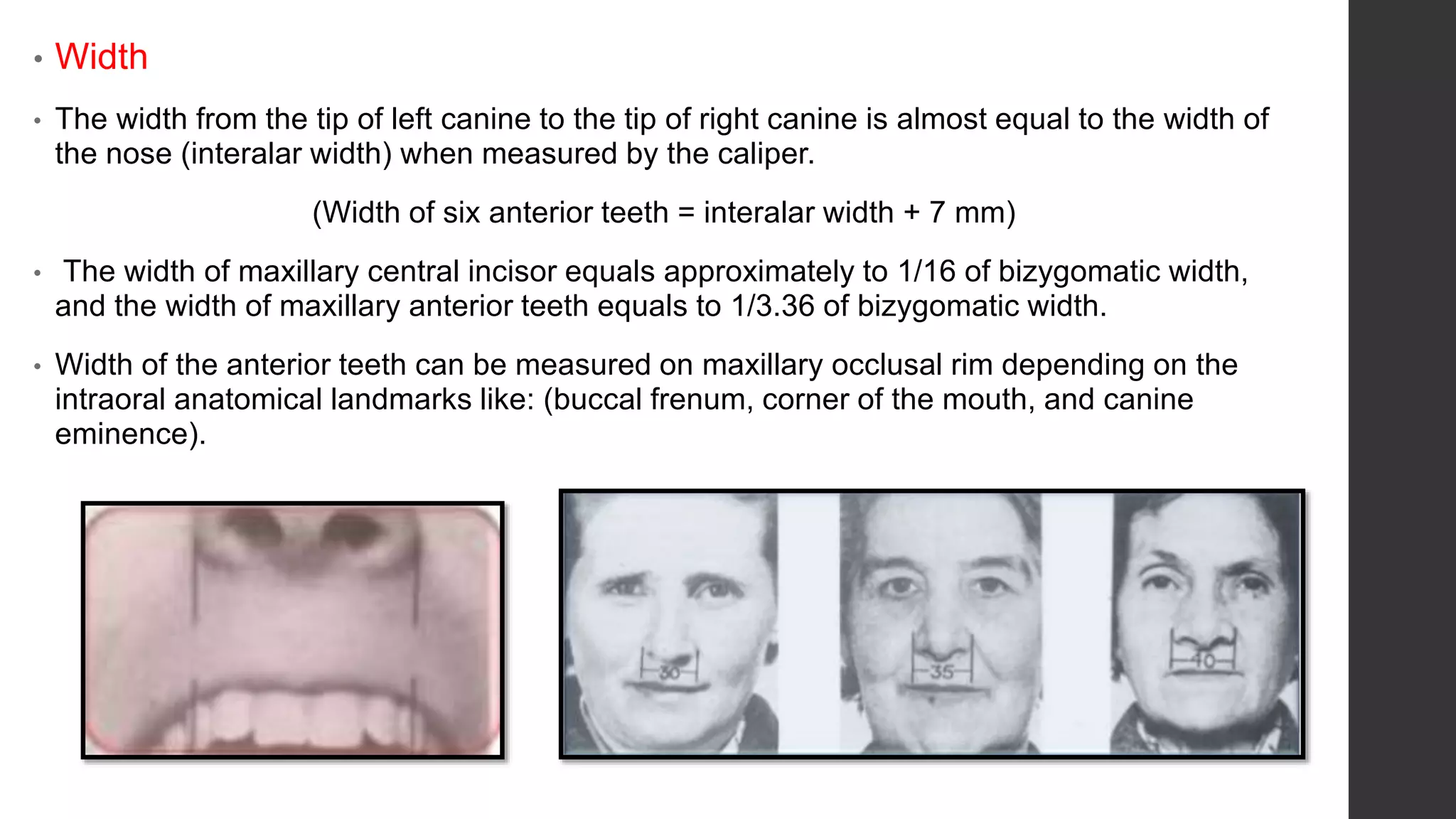 Teeth selection in complete dentures | PPTX