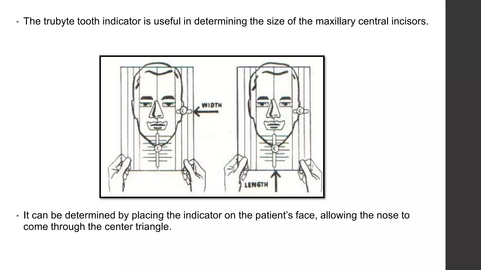 Teeth selection in complete dentures | PPTX
