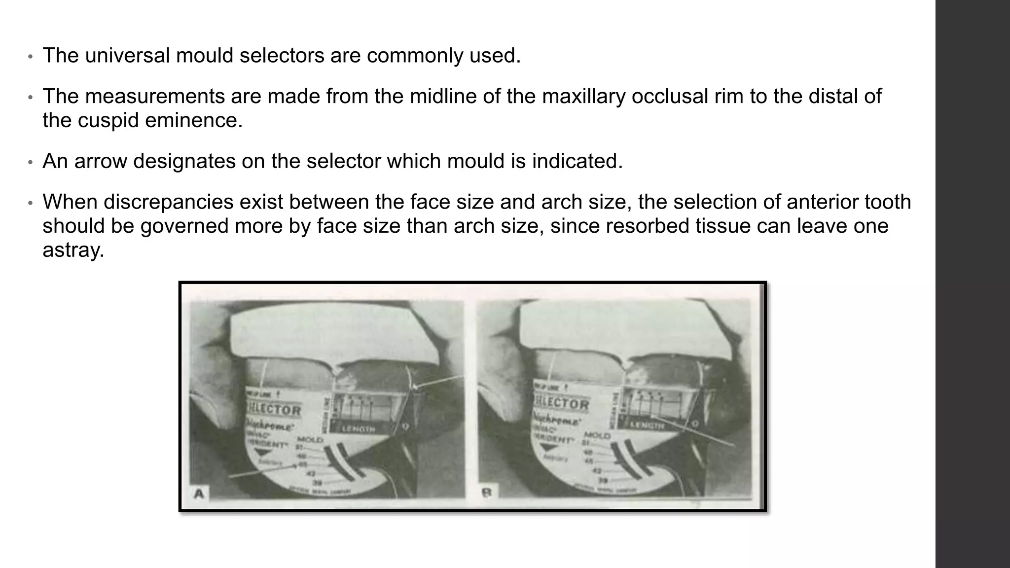 Teeth selection in complete dentures | PPTX