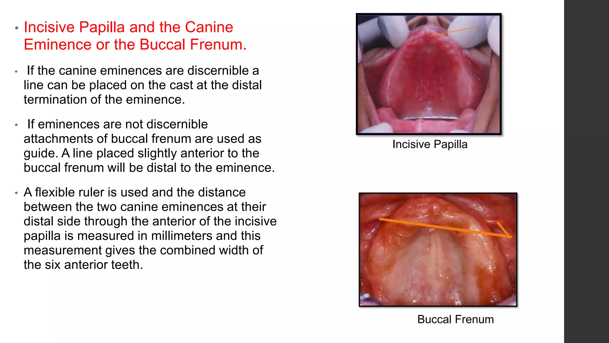 Teeth selection in complete dentures | PPTX