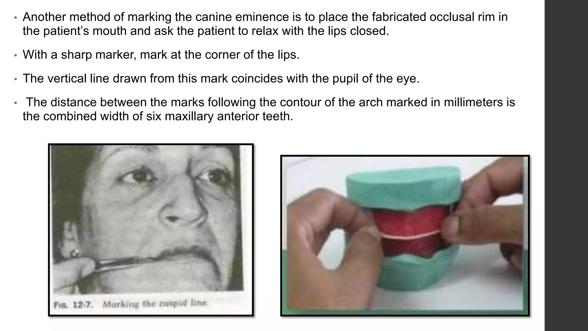 Teeth selection in complete dentures | PPTX