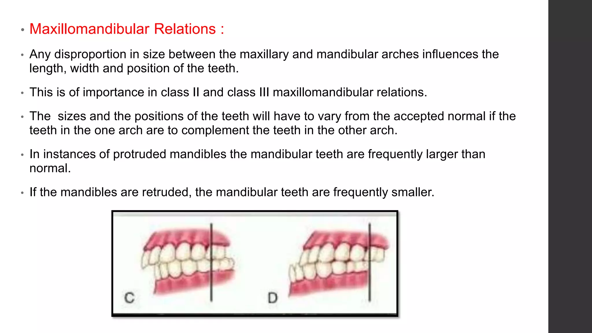 Teeth selection in complete dentures | PPTX