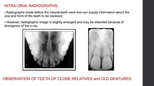 Teeth selection in complete dentures | PPTX | Dental Health | Diseases ...