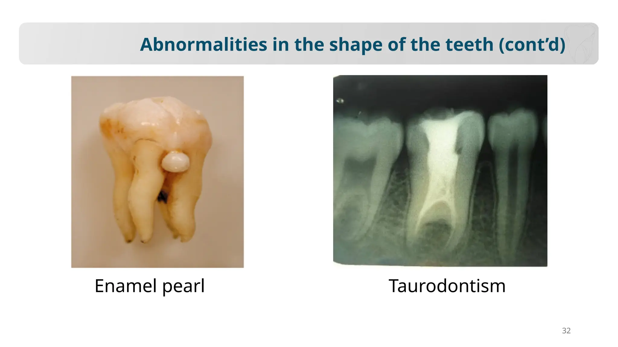 Development and developmental anomalies of teeth.pptx