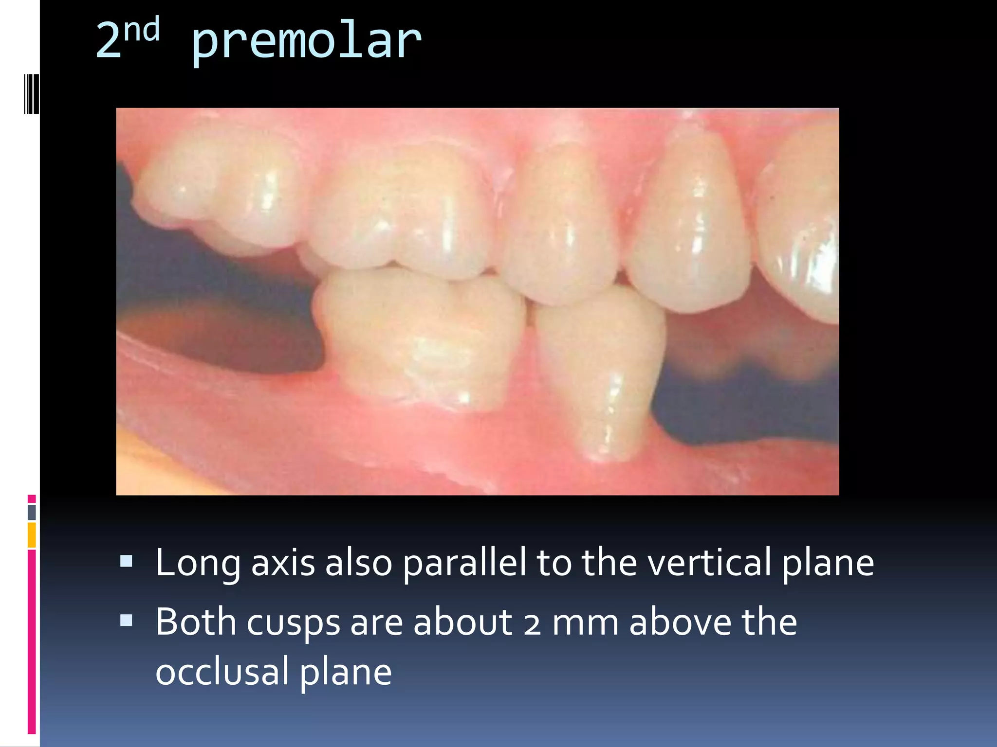 Teeth setup | PPTX