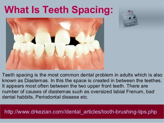 Teeth spacing