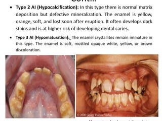 Teeth stains and discolorations | PPTX