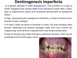 Teeth stains and discolorations | PPTX