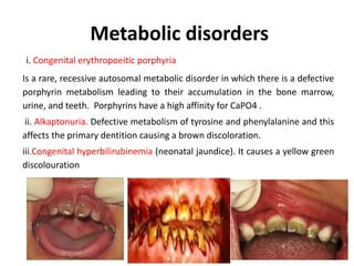 Teeth stains and discolorations | PPTX