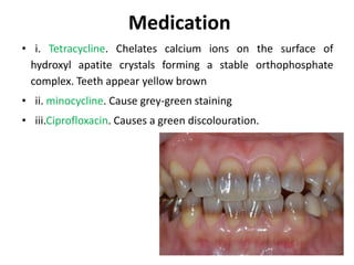 Teeth stains and discolorations | PPTX