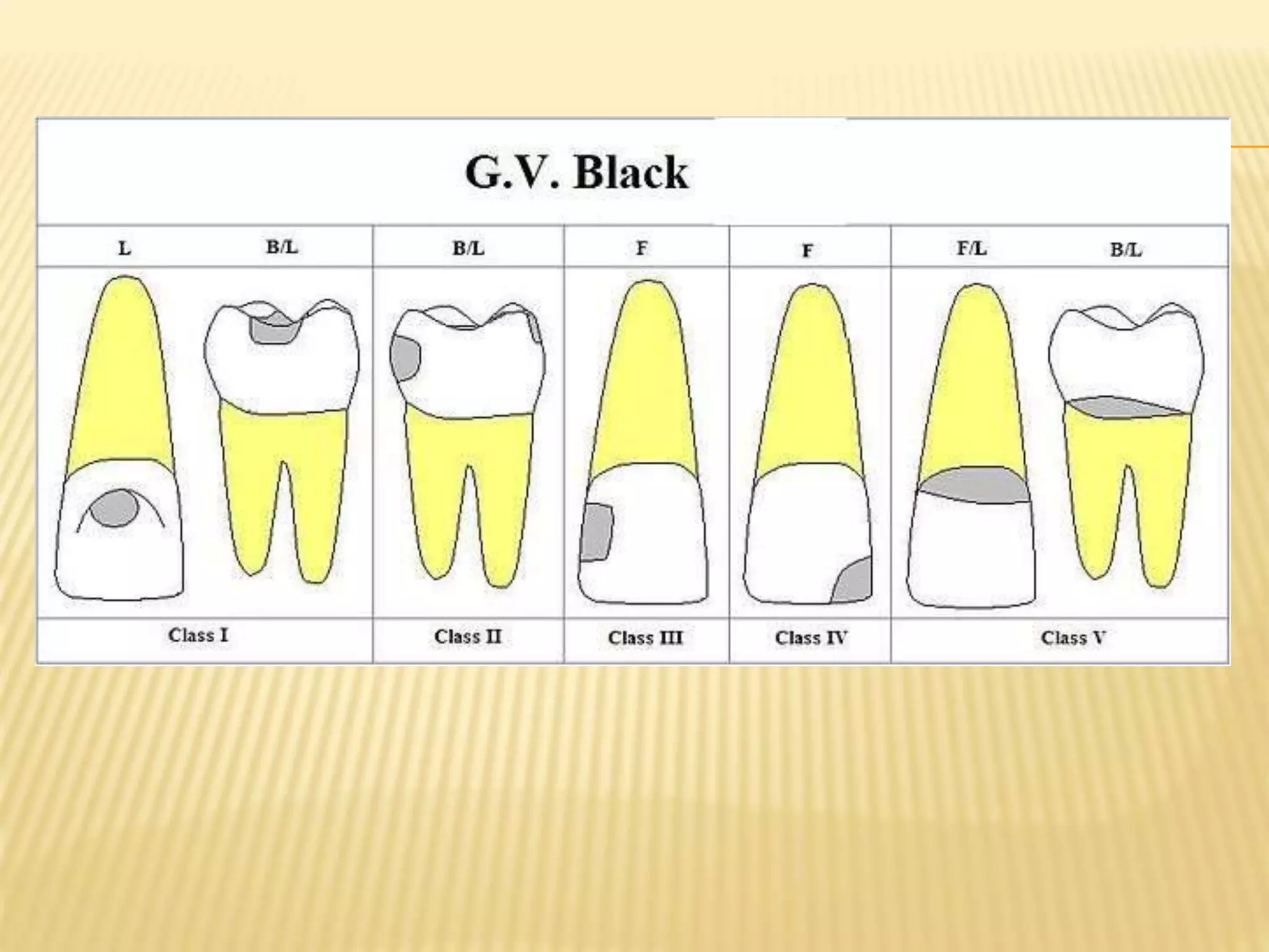 Teeth structure and cavities | PPTX