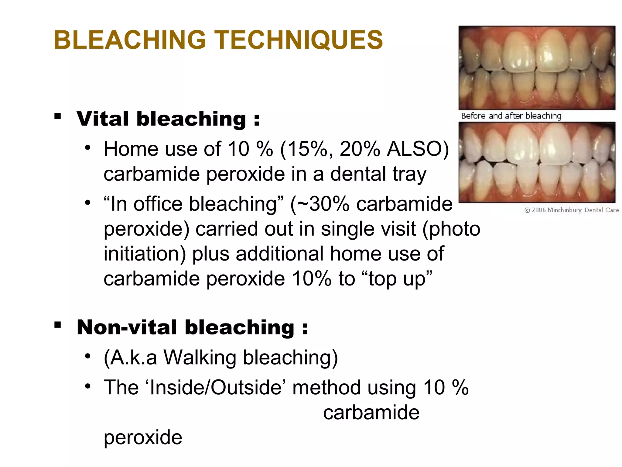 Teeth whitening lecture(1) | PPT