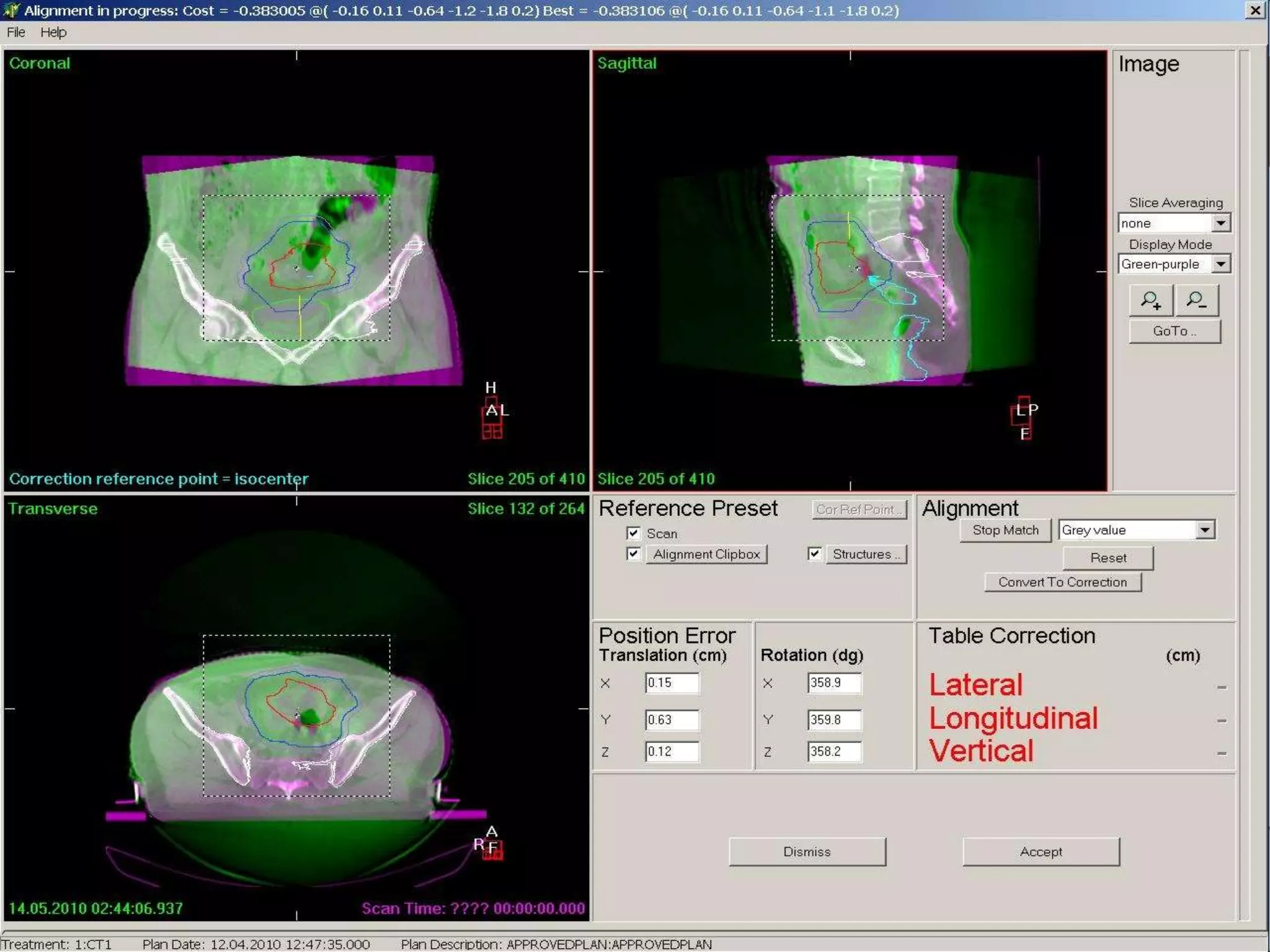 CT based Image Guided Radiotherapy - Physics & QA | PPTX | Cameras and Camcorders | Consumer ...