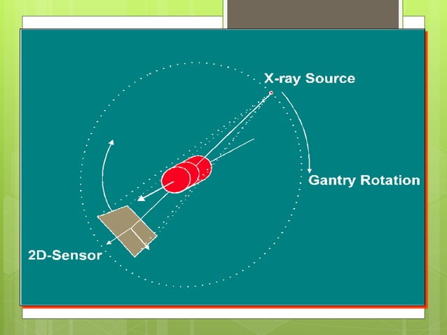 CT based Image Guided Radiotherapy - Physics & QA | PPTX | Cameras and Camcorders | Consumer ...