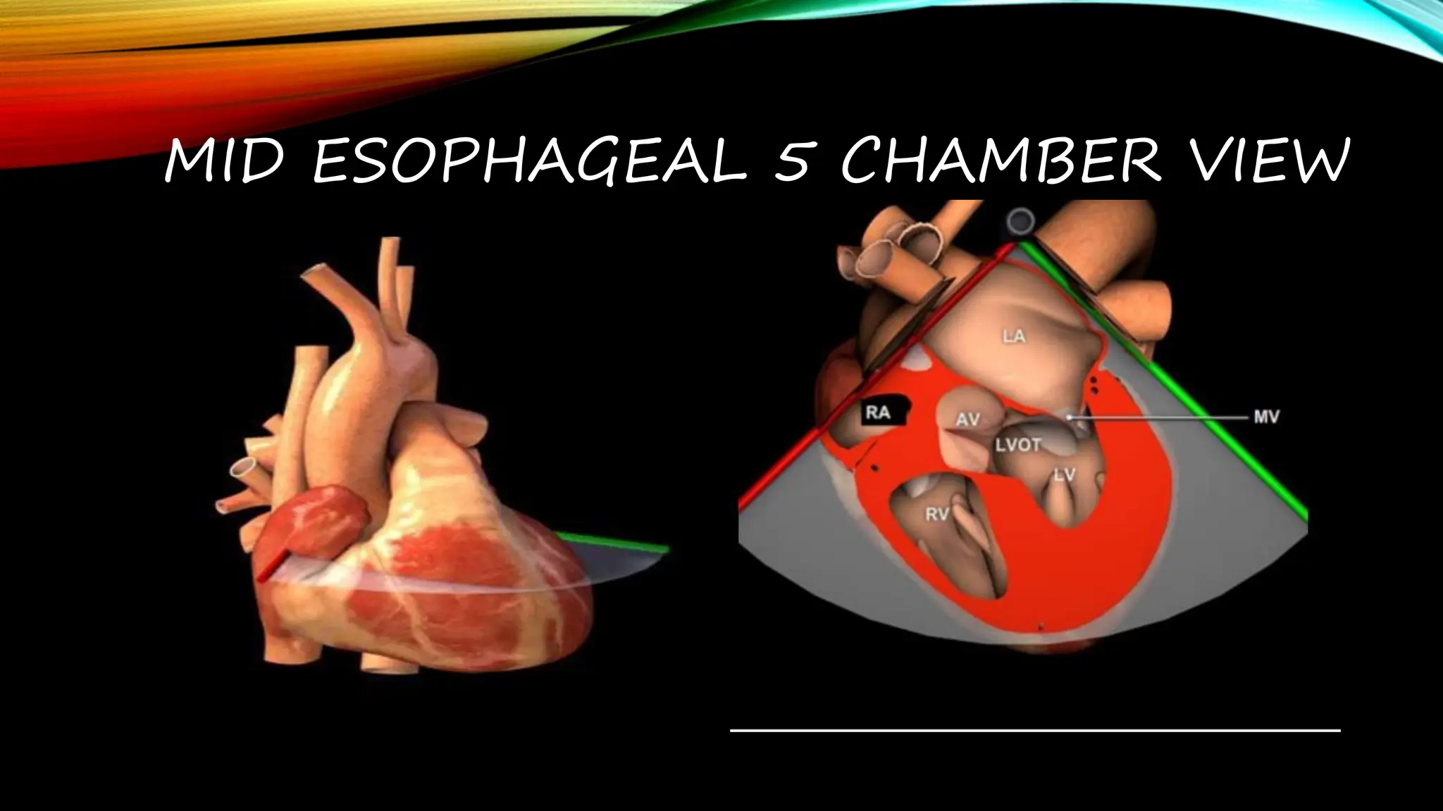 TEE VIEWS transesophageal echocardiography views.pptx