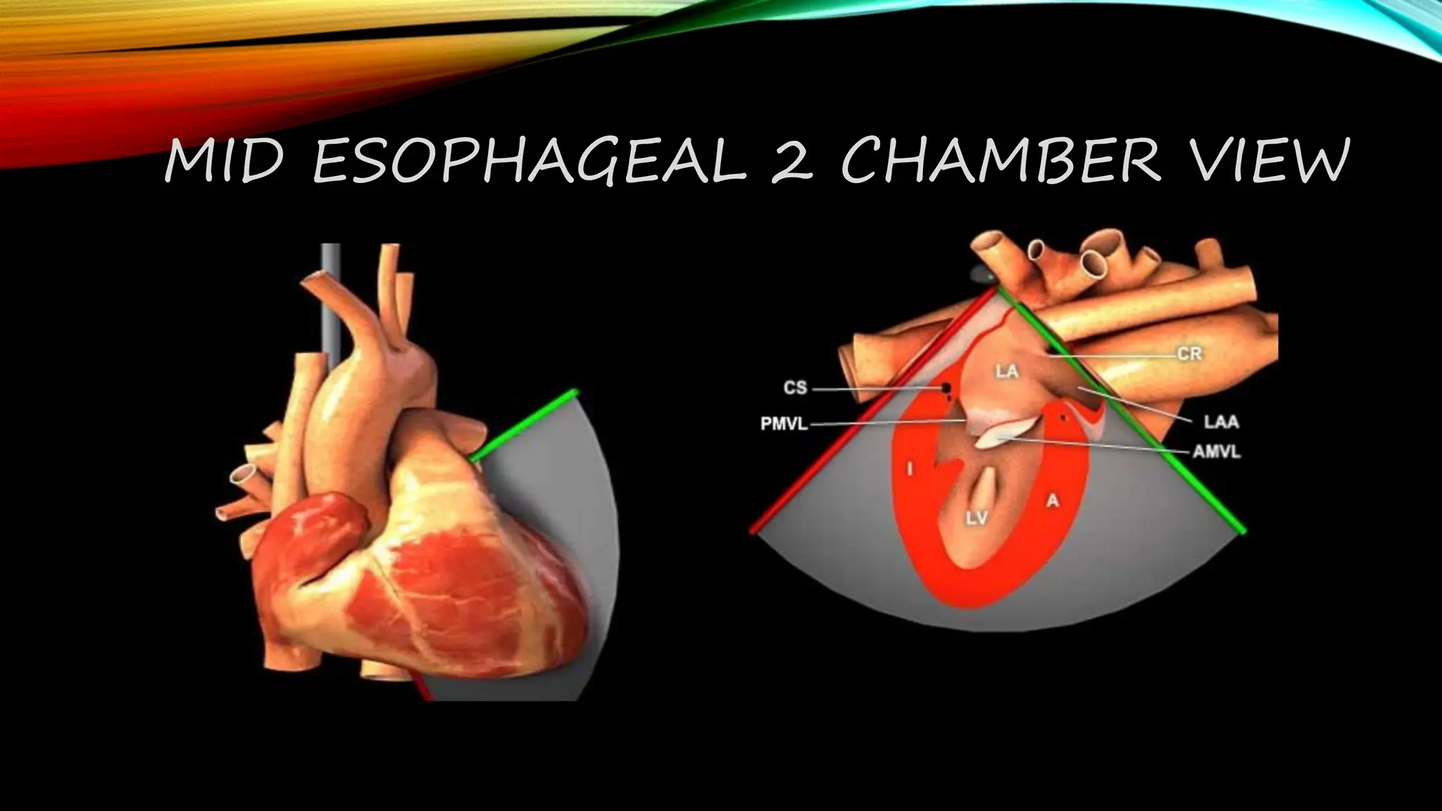 TEE VIEWS transesophageal echocardiography views.pptx