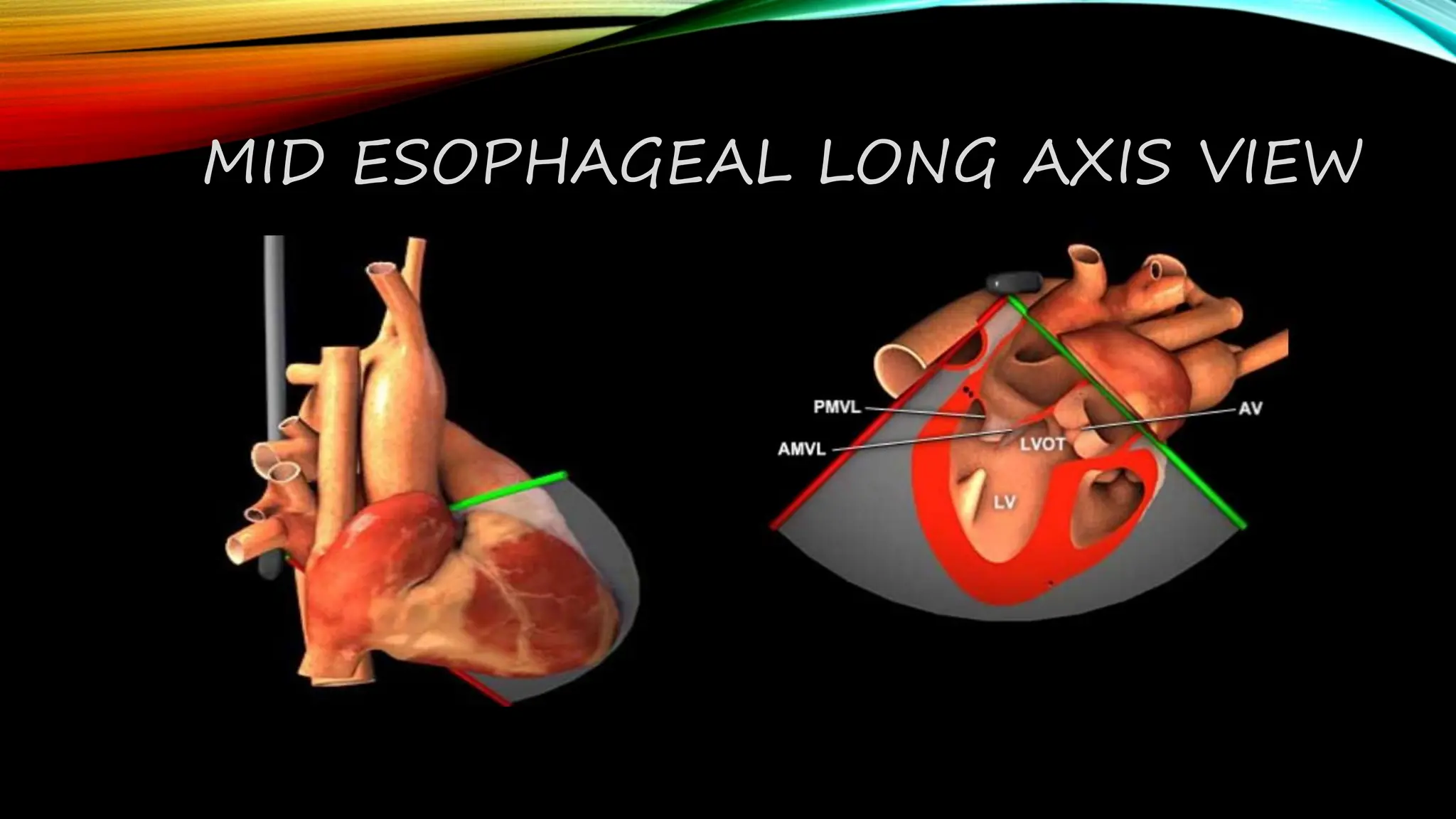 TEE VIEWS transesophageal echocardiography views.pptx