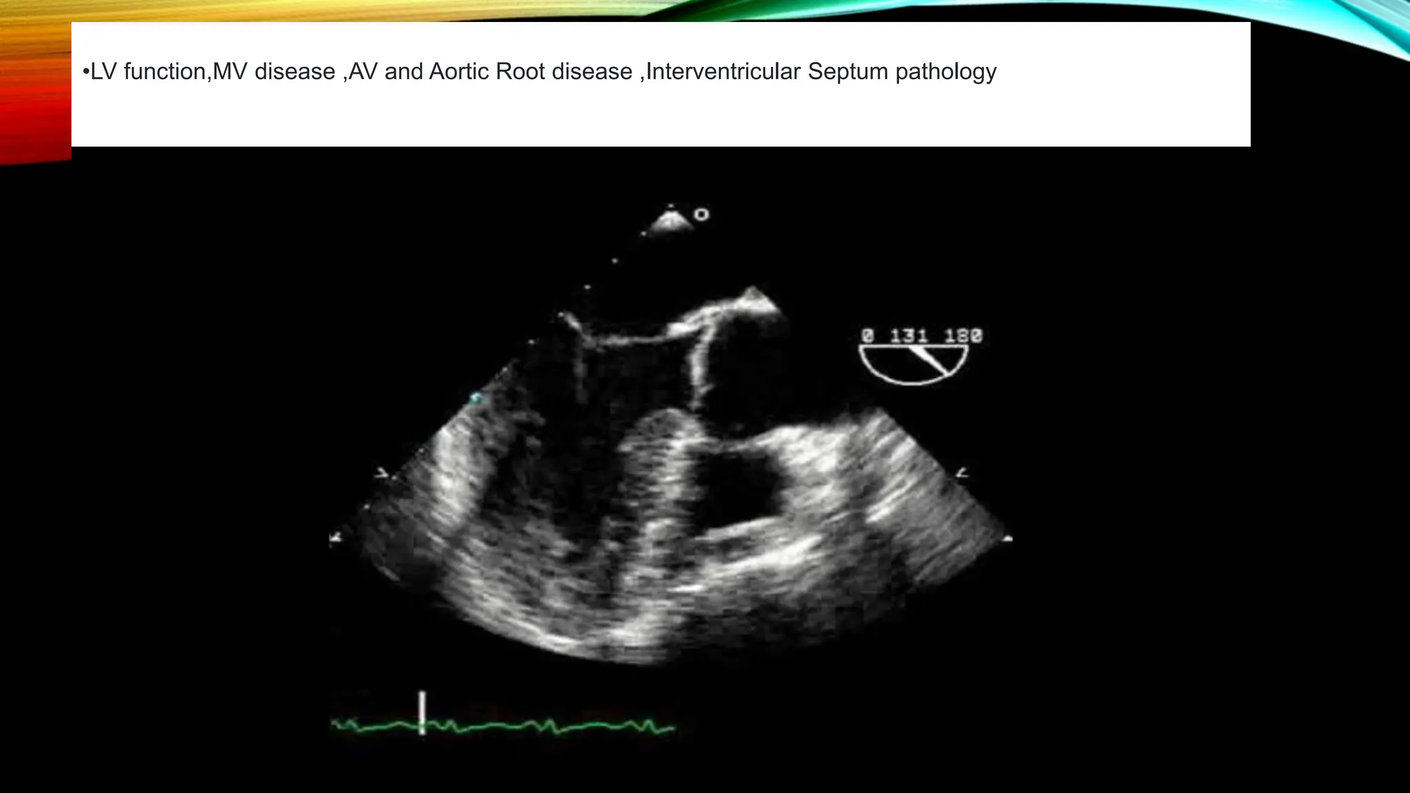 TEE VIEWS transesophageal echocardiography views.pptx