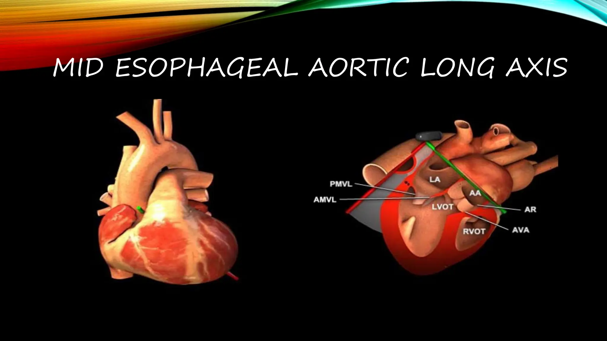 TEE VIEWS transesophageal echocardiography views.pptx