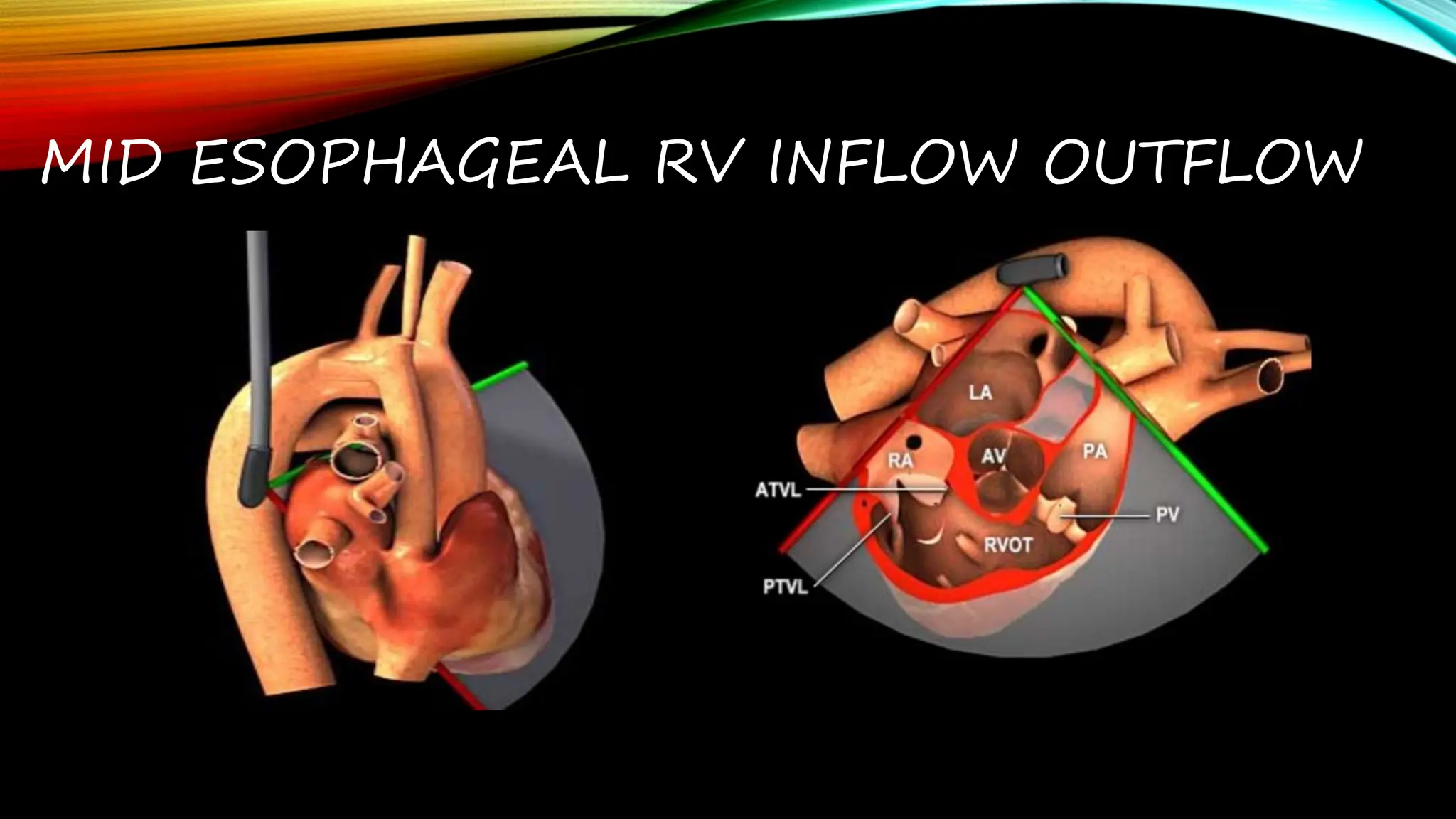 TEE VIEWS transesophageal echocardiography views.pptx