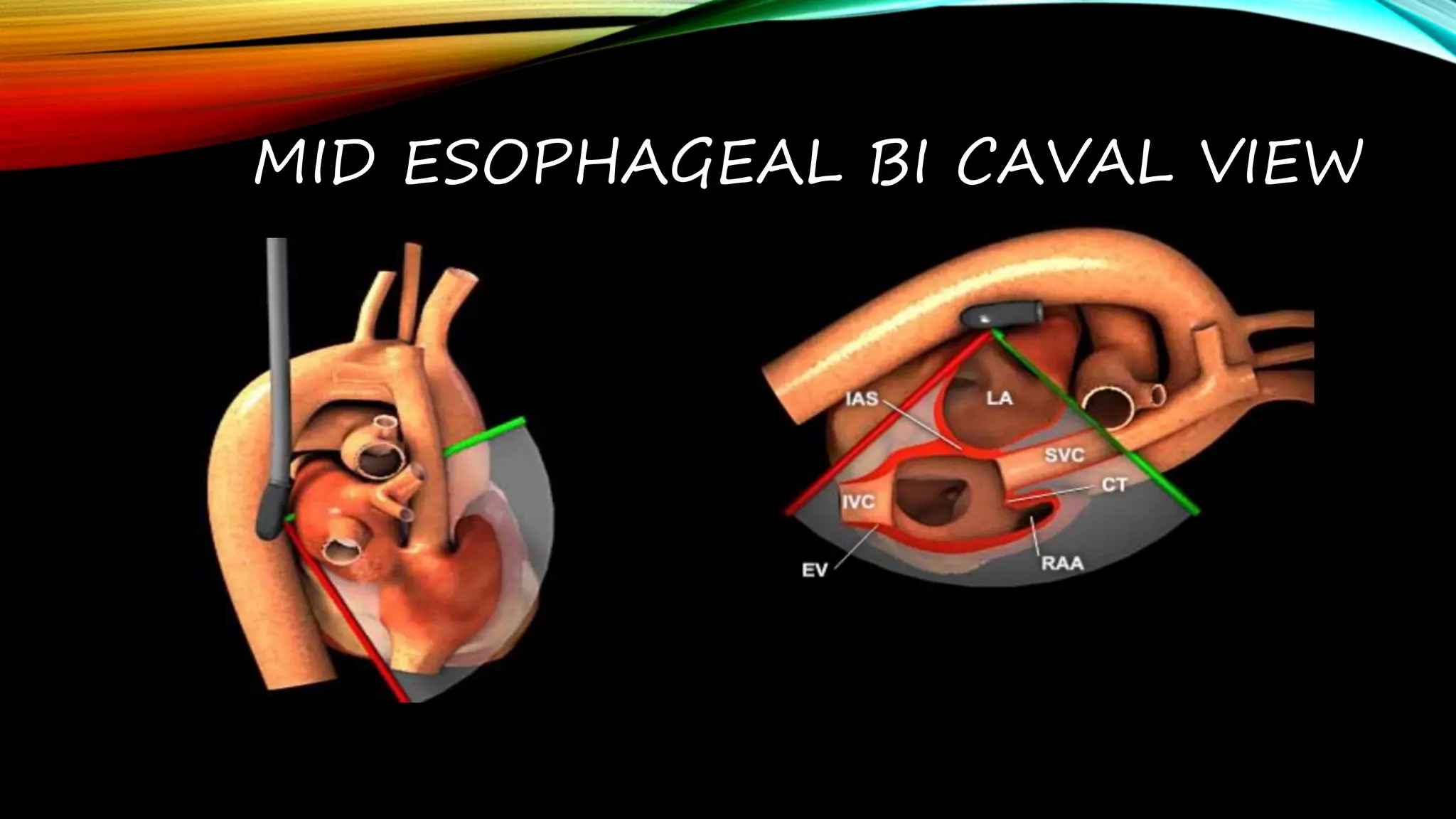 TEE VIEWS transesophageal echocardiography views.pptx