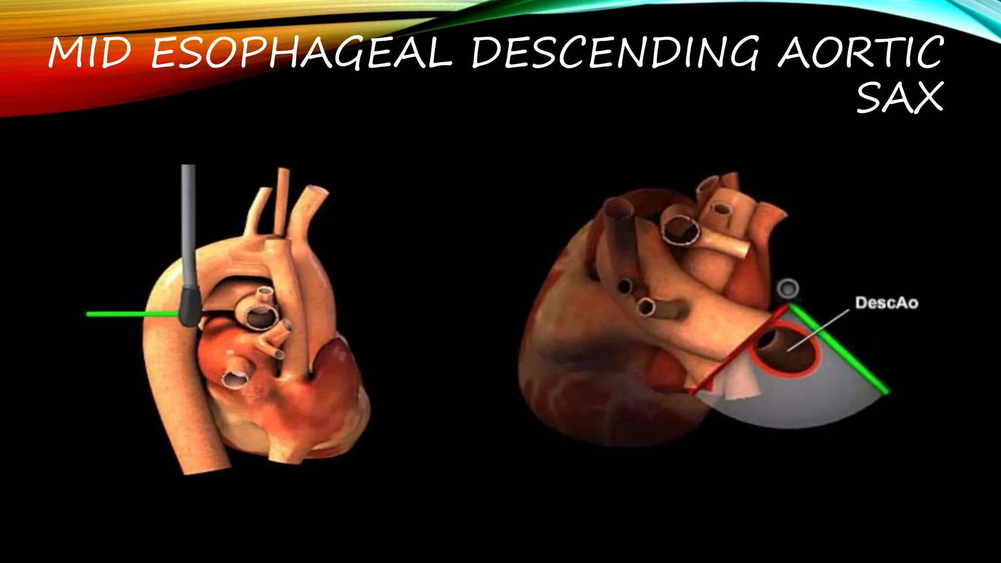 TEE VIEWS transesophageal echocardiography views.pptx