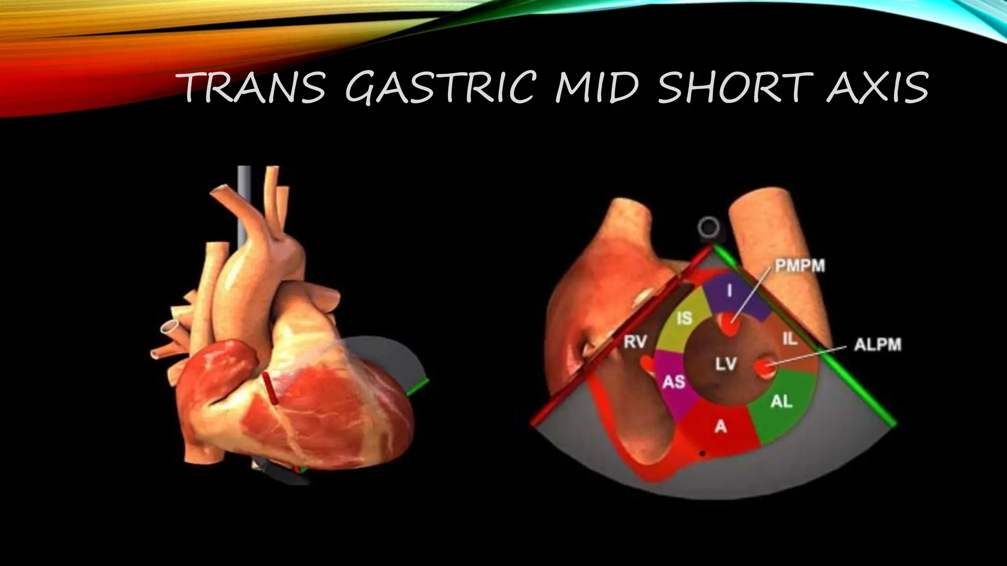 TEE VIEWS transesophageal echocardiography views.pptx