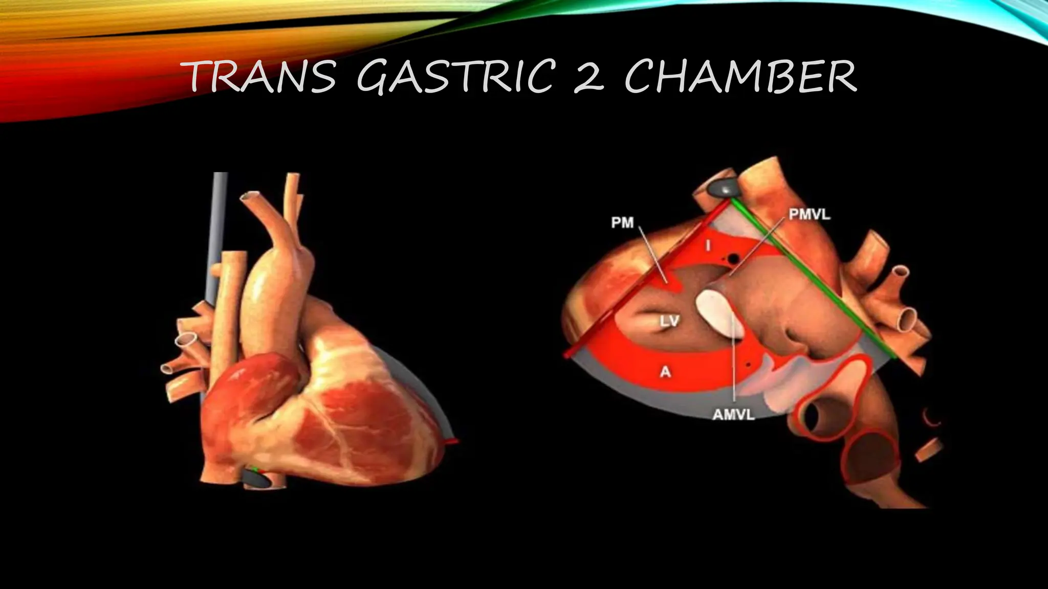 TEE VIEWS transesophageal echocardiography views.pptx