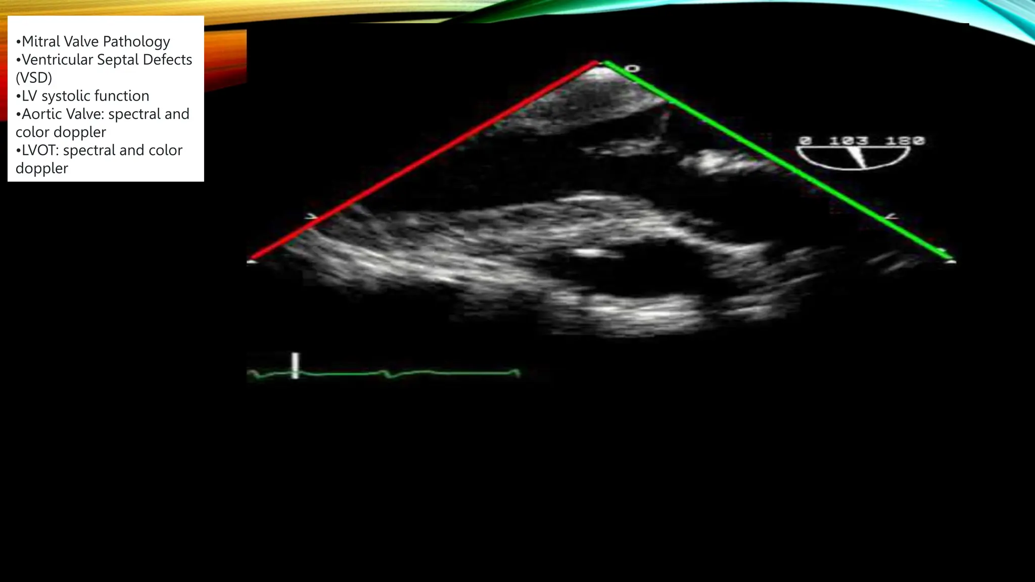 TEE VIEWS transesophageal echocardiography views.pptx