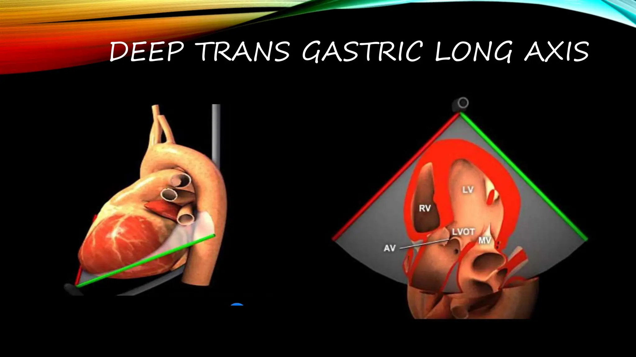 TEE VIEWS transesophageal echocardiography views.pptx