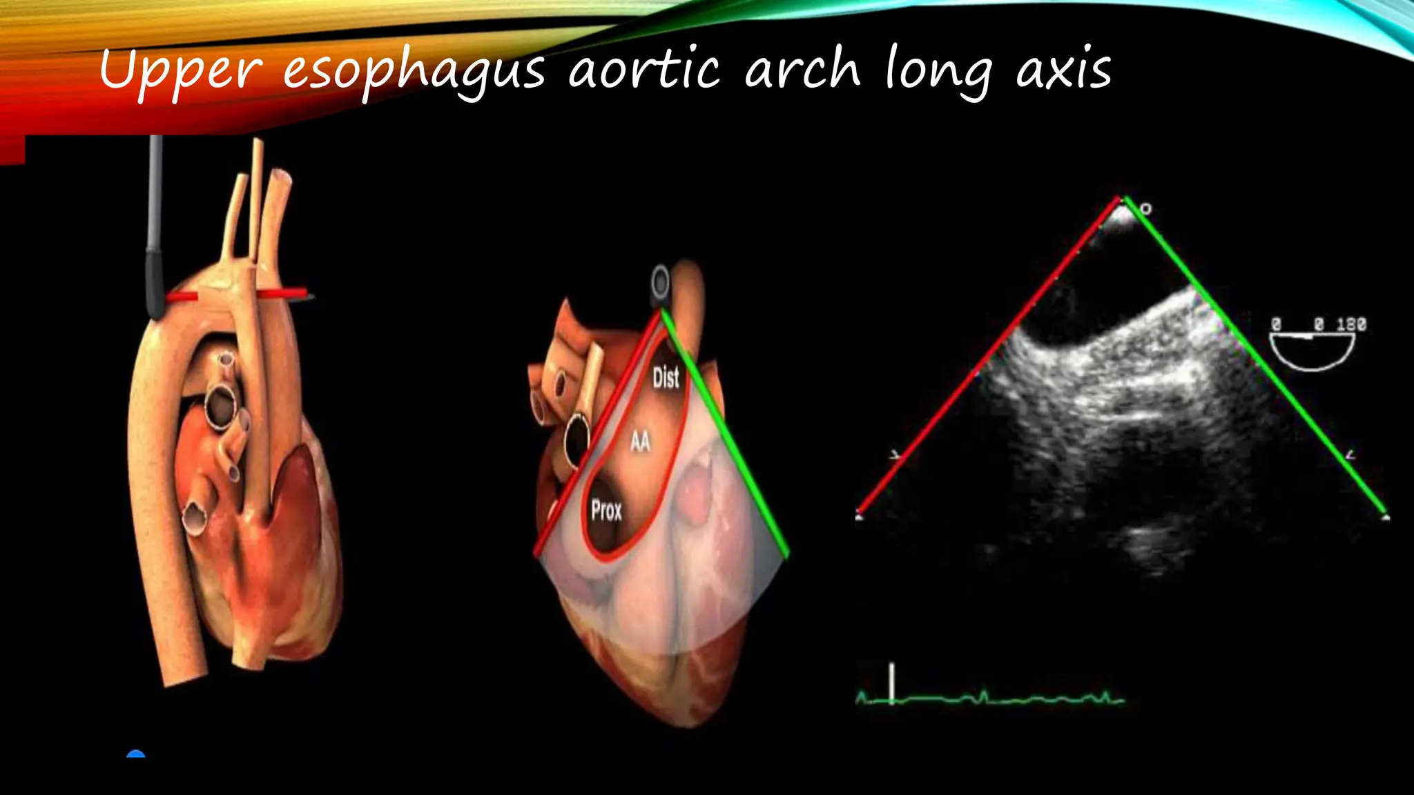 TEE VIEWS transesophageal echocardiography views.pptx