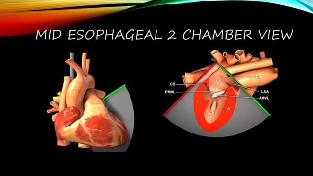 TEE VIEWS transesophageal echocardiography views.pptx | Heart and ...