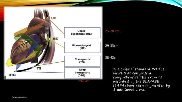 TEE VIEWS transesophageal echocardiography views.pptx | Heart and ...