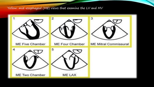 TEE VIEWS transesophageal echocardiography views.pptx | Heart and ...