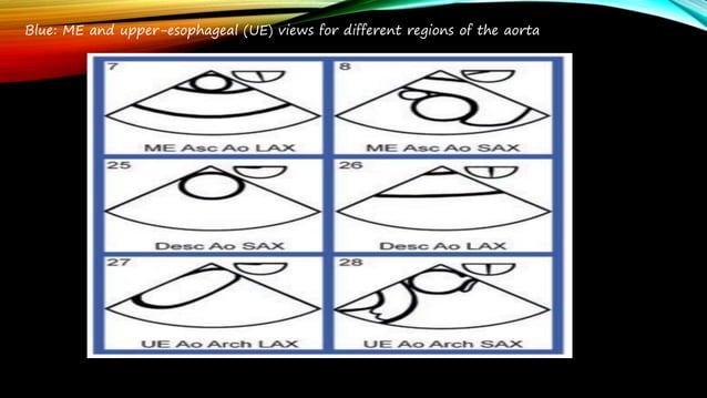 TEE VIEWS transesophageal echocardiography views.pptx | Heart and ...