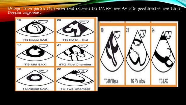 TEE VIEWS transesophageal echocardiography views.pptx | Heart and ...