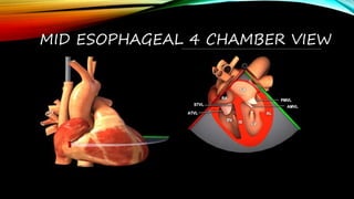 TEE VIEWS transesophageal echocardiography views.pptx