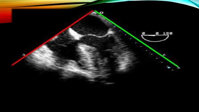 TEE VIEWS transesophageal echocardiography views.pptx | Heart and ...