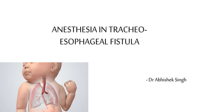 Anesthetic Considerations in Tracheo-esophageal Fistula | PPTX | Lung ...