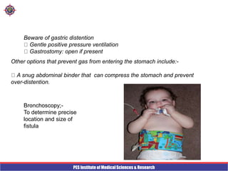 Tef.class ppt. shahin taj mam class | PPT