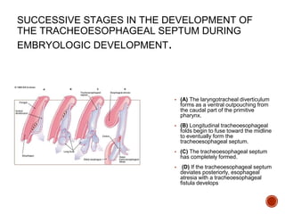 tef.pptx | Pregnancy | Reproductive Health