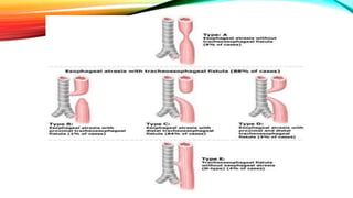 Tef ppt new | PPTX