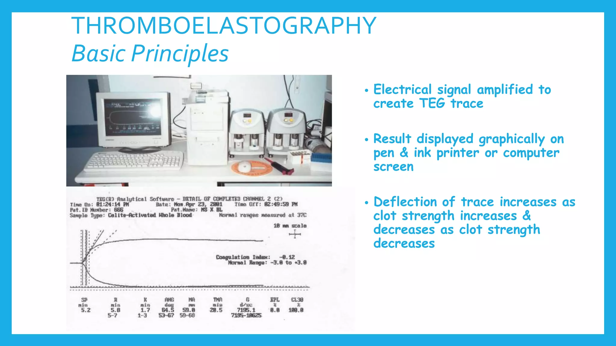 TEG - Thromboelastography | PPTX