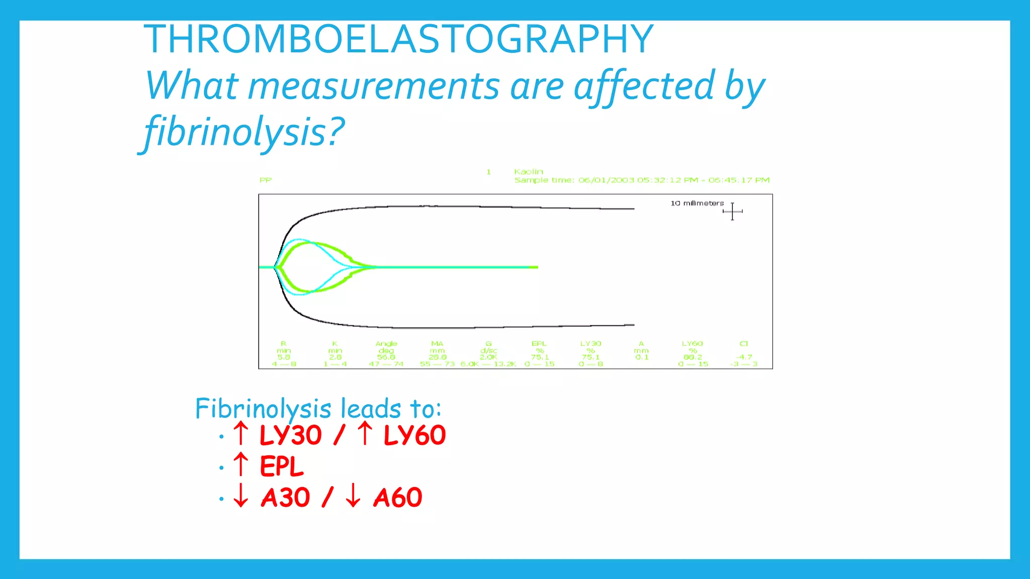 TEG - Thromboelastography | PPTX