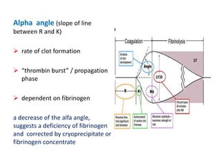 Teg Thrombelastograph® .pptx