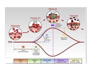 Teg Thrombelastograph® .pptx