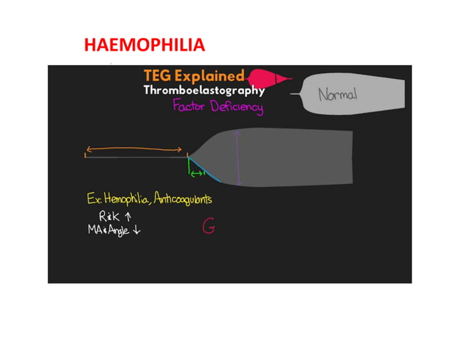 Teg Thrombelastograph® .pptx