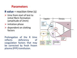 Teg Thrombelastograph® .pptx